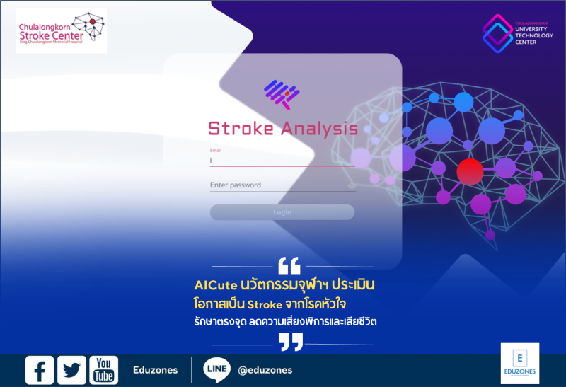 AICute นวัตกรรมจุฬาฯ ประเมินโอกาสเป็น Stroke จากโรคหัวใจ รักษาตรงจุด ลดความเสี่ยงพิการและ ...